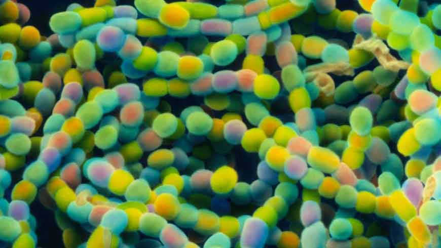 Why Is 70% Isopropyl Alcohol (IPA) a Better Disinfectant than 99% ...